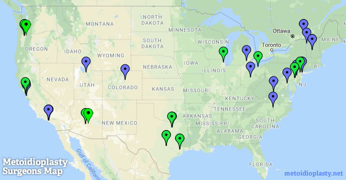 Metoidioplasty Surgery Guide: Surgeons, Recovery, Results