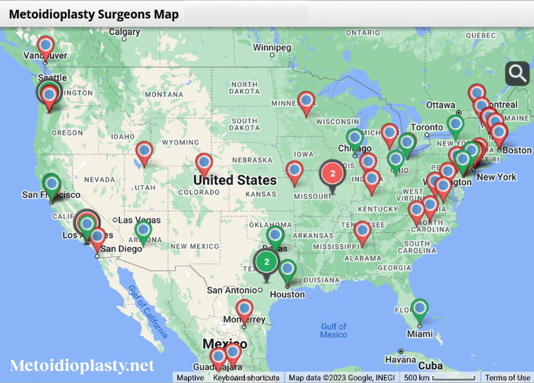 Metoidioplasty Surgery Guide - Your Surgical Options Explained
